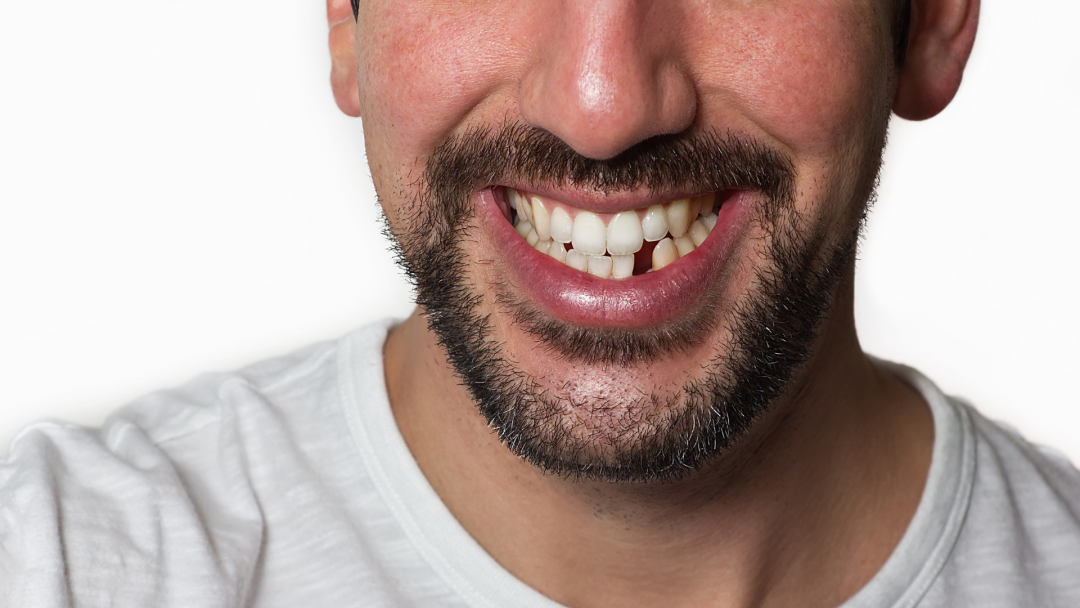 A Guide to Knocked Out Tooth Emergencies - First Aid Training