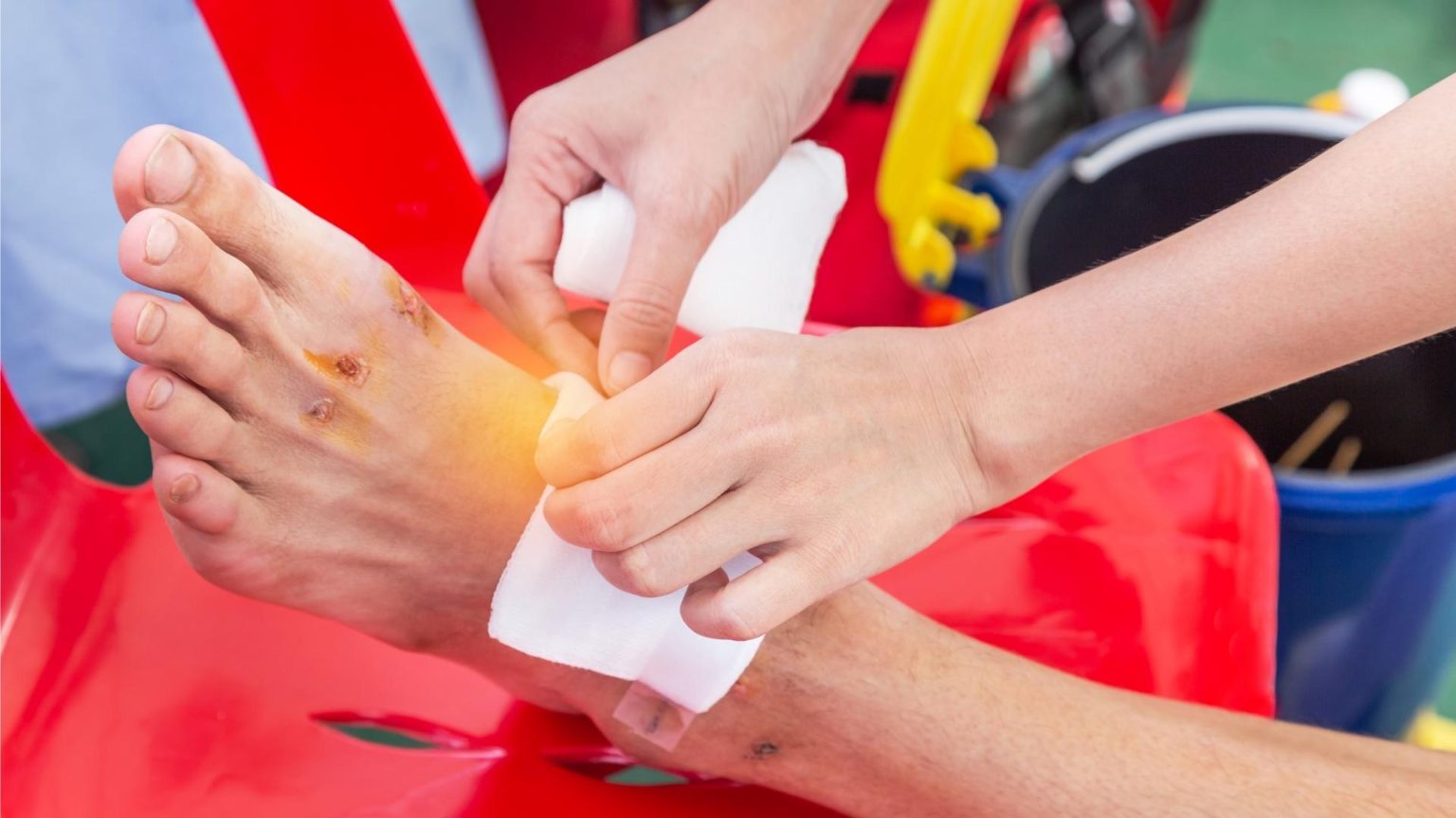 Tips on How to Make a Bruise Stop Hurting | Coast2Coast