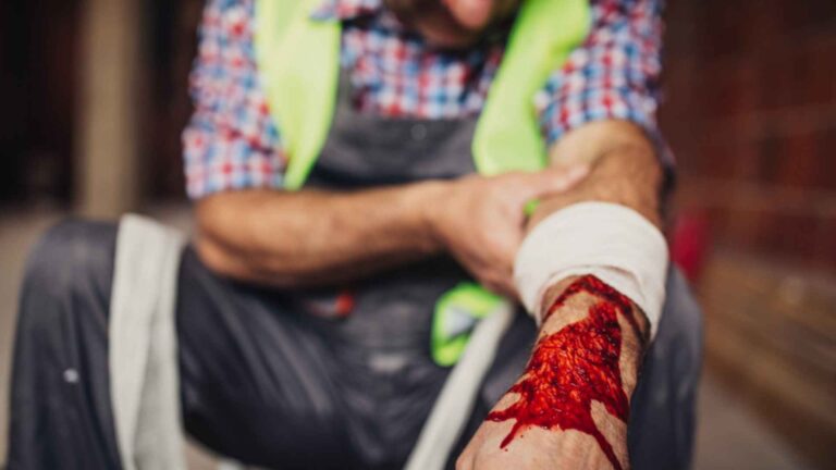 First Aid for Broken Bones | Coast2Coast